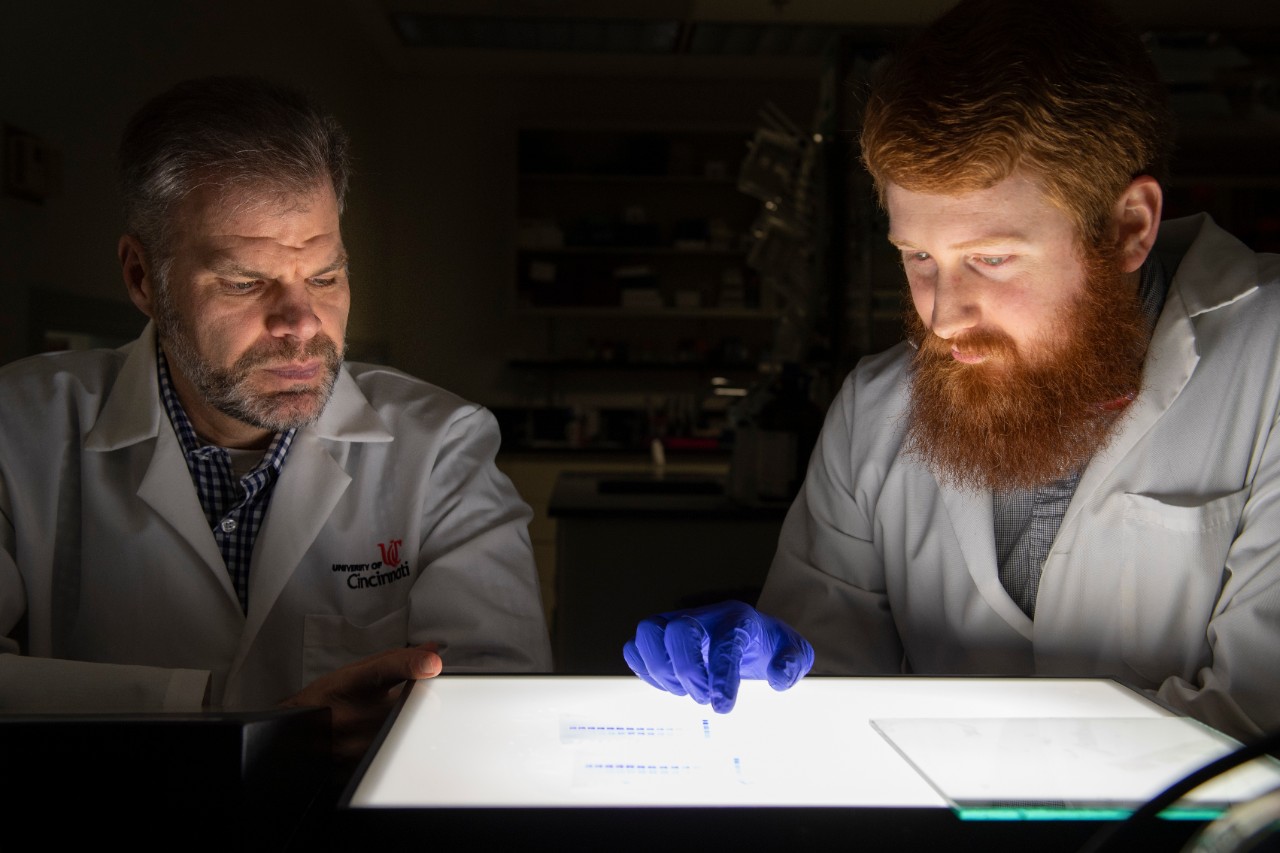 Fat-busting proteins made in a lab may treat heart disease | University ...