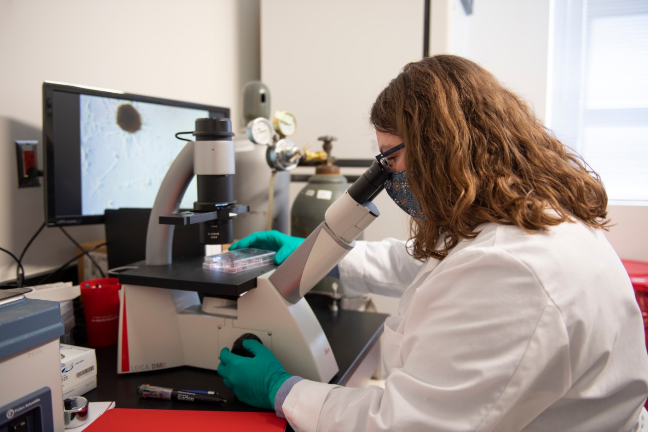 UC scientist shares a journey battling endometriosis up close and ...