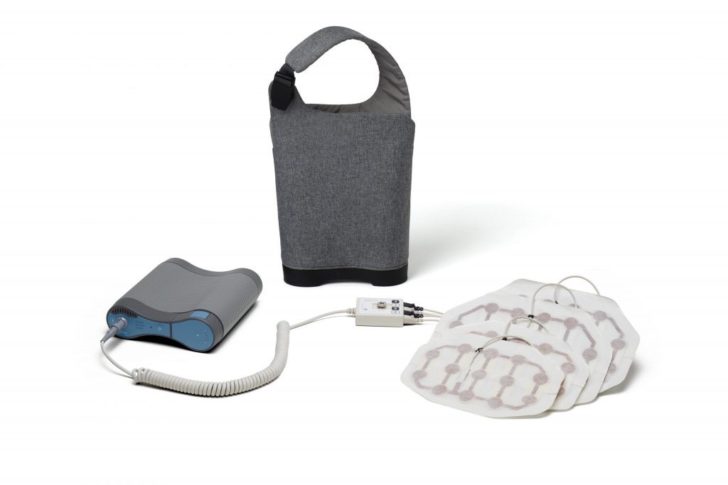 UC trial examines electric therapy to treat glioblastomas | University ...