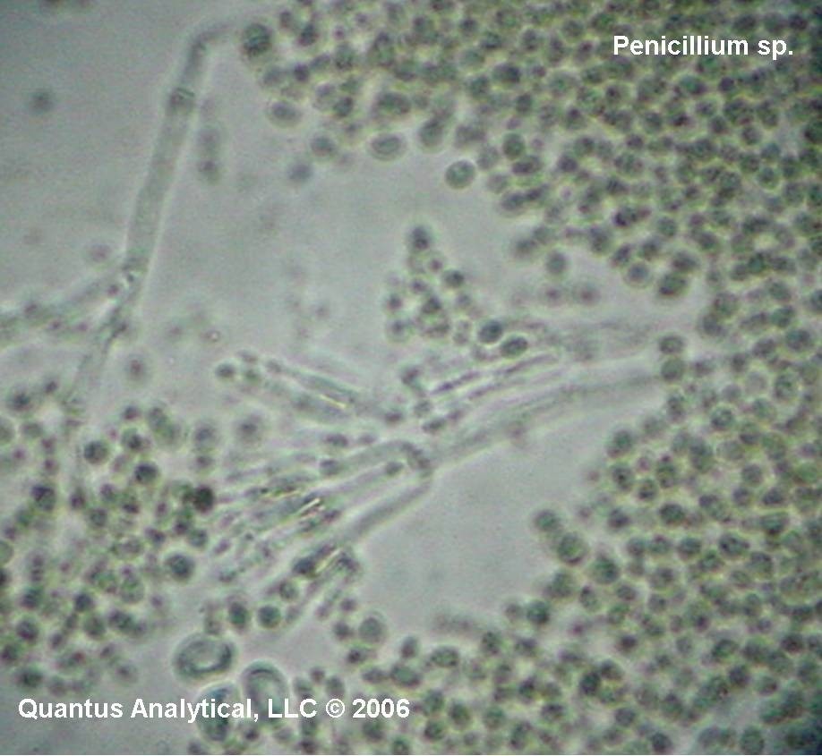 Airborne Mold Spores Increase Kids Risk for Multiple Allergies ...