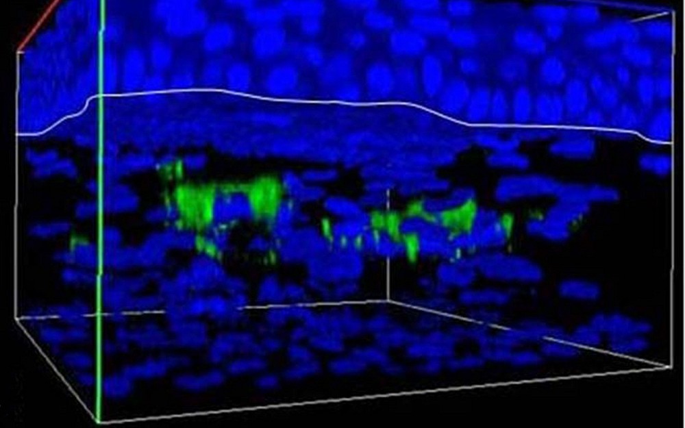 Bone Marrow Stem Cells May Cure Eye Disease | University of Cincinnati